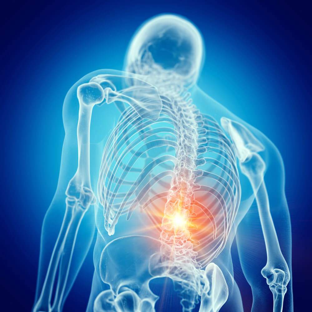 Back Pain